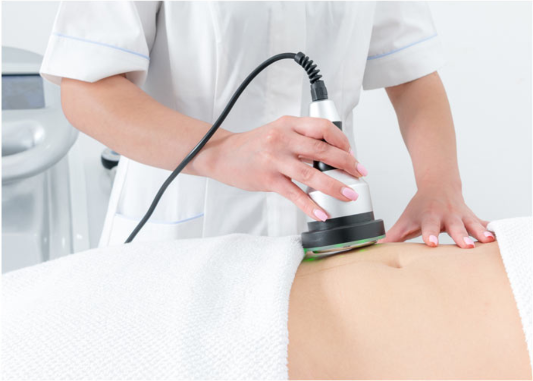 Ultrasound Cavitation - Non-Invasive Fat Reduction | Medical Zone