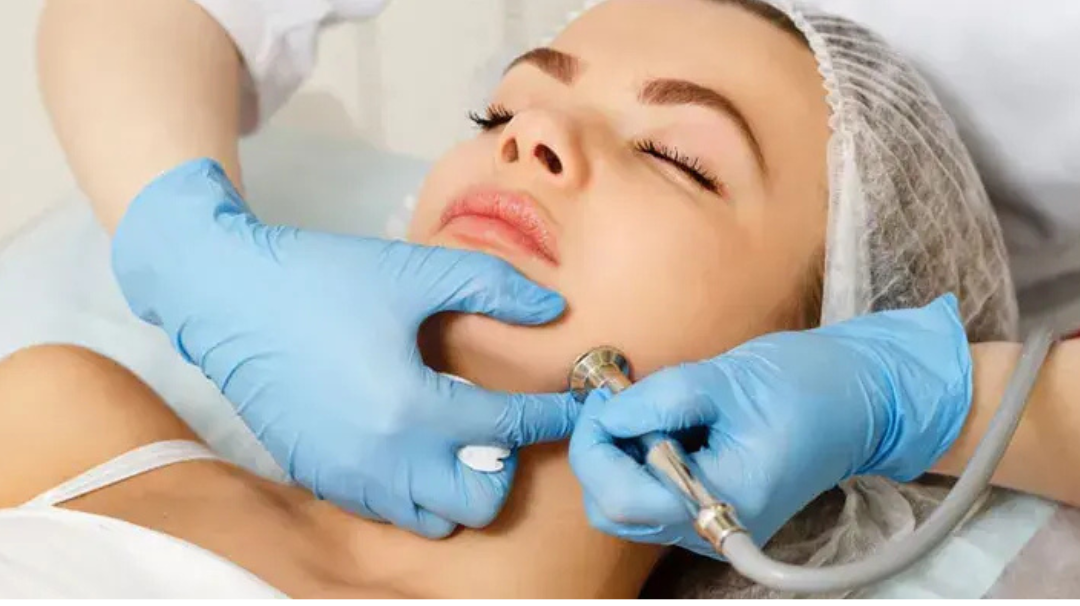 Microdermabrasion Treatment for Skin Rejuvenation | Medical Zone